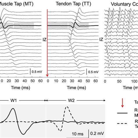 Patterns Of Propagation Of The Emg Signal A Propagation Patterns Of Download Scientific
