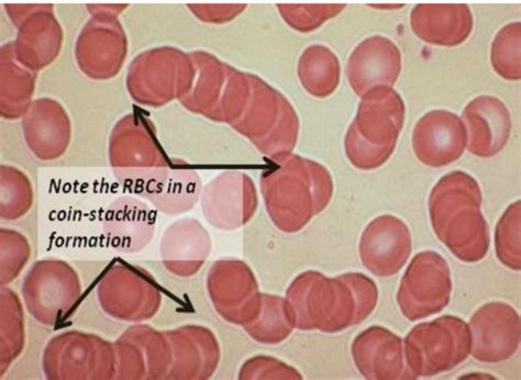 Hema Lec 6 Page 1 2 Rbc Structure And Function Hemoglobin Synthesis Flashcards Quizlet