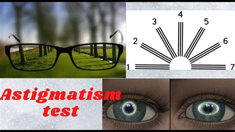 Eye Test Chart Astigmatism At Chester Cohrs Blog