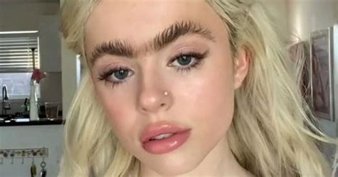 Woman With Bushy Unibrow Branded Caveman Feels Happier Since