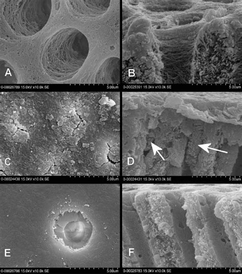 Representative Scanning Electron Microscopy Sem Micrographs Of Dentin