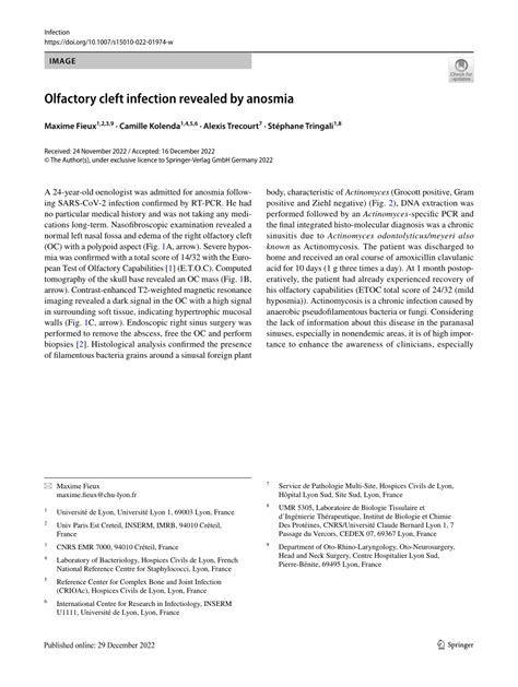 Pdf Olfactory Cleft Infection Revealed By Anosmia
