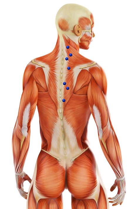 Myofascial Pain Syndrome Uncovering The Root Causes