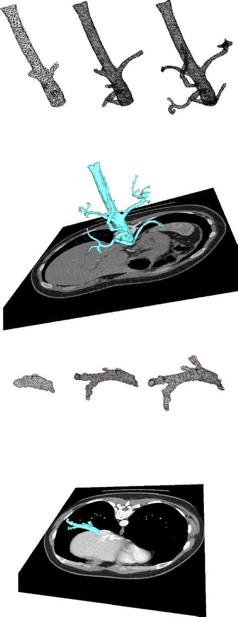 Figure 4 From Robust Segmentation Of Anatomical Structures With Deformable Surfaces And Marching