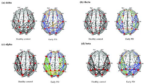 corresponding brain functional networks between early pd and hc groups