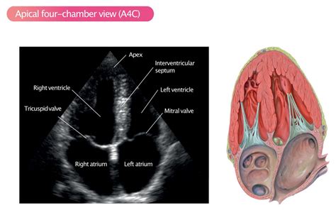Standard Transthoracic Echocardiogram Complete Imaging Protocol Ecg
