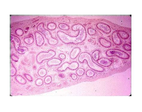 Epididymis Histology Slide Quiz