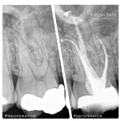 Kreena Patel On Linkedin Lovewhatyoudo 13 Comments