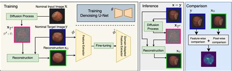 Anomaly Detection Ddad Anomaly Detection With Conditioned Denoising