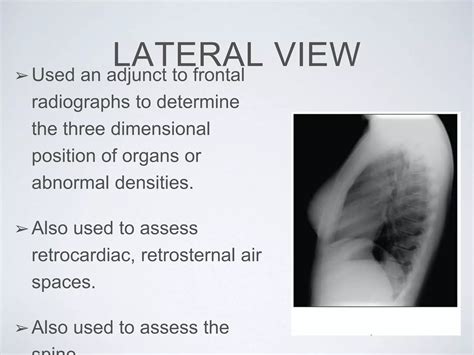 Basics Of Cxr Modified Ppt PPTX