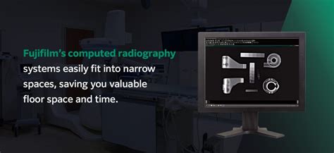 What Is Cr Digital Radiography Computed Radiography