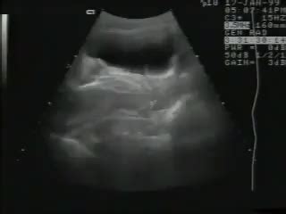 Sex Through An Ultrasound X Post From R Wtf Scrolller