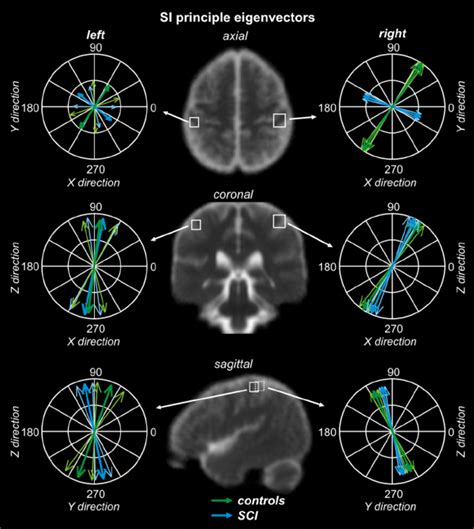 Principal Eigenvectors In Control And SCI Subjects In The SI Region In