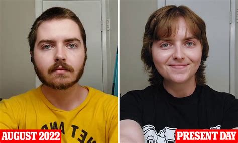 Transgender Woman Before And After