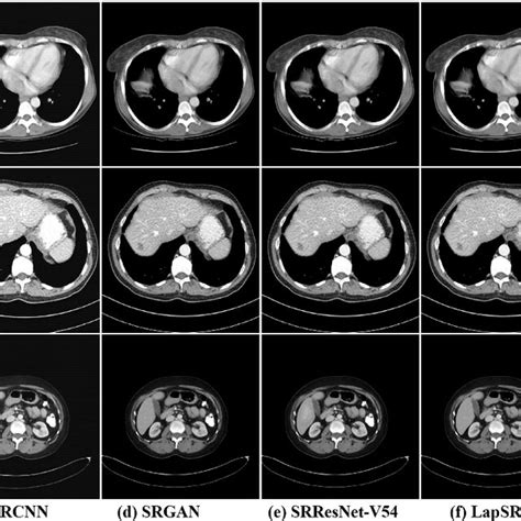 4 × Reconstruction Results Of Three Ct Slices Using Different