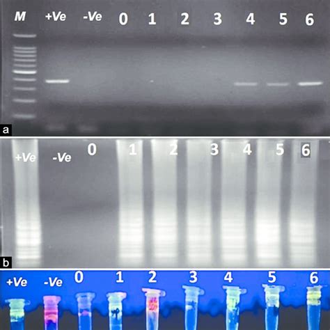 Sensitivity Evaluation Of Loop Mediated Isothermal Amplification Lamp Download Scientific