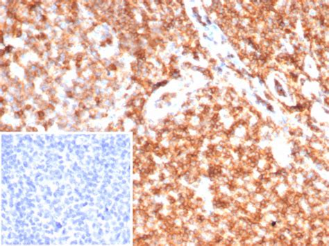 Cd45 Lca B Cell Marker Monoclonal Antibody Rptprc 7275 5788 Msm45 P1abx