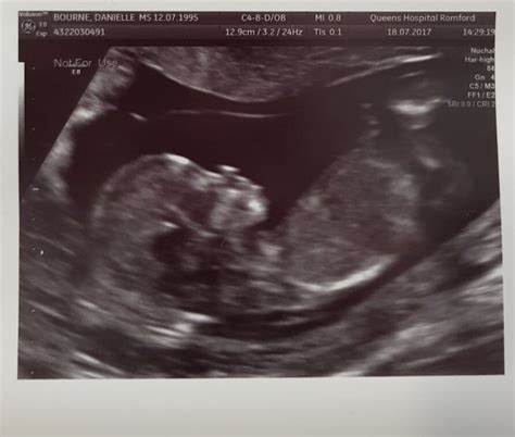 Scan Pictures Xxx