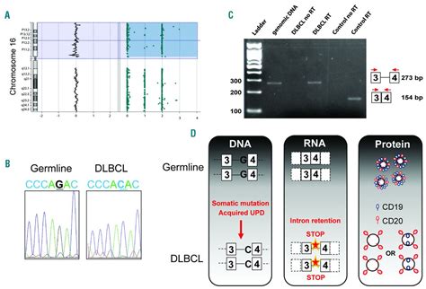 Molecular Analysis Of A Cd19 Negative Diffuse Large B Cell Lymphoma