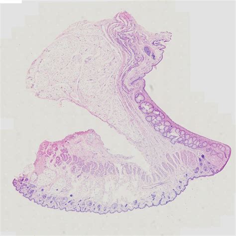 Eyelid Histology Integumentary System Histology Eyelid Histology