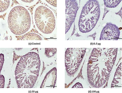 Photomicrograph Of Testis Showing Immunohistochemical Localization Of Download Scientific