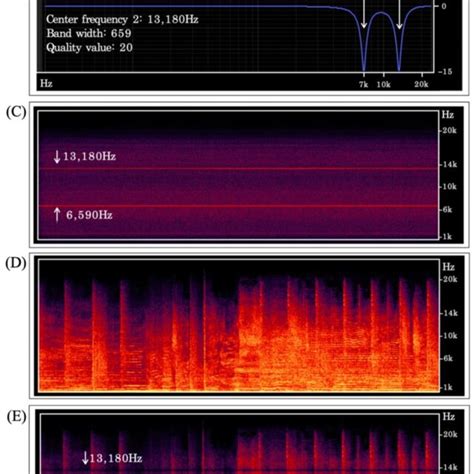 A Spectrogram Analysis Result Of Music And Handpiece Noise Using Fft
