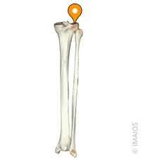 Superior Articular Surface Of Lateral Condyle E Anatomy Imaios