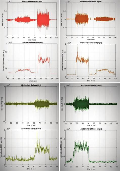 A Example Of Raw Surface Electromyography And Root Mean Square