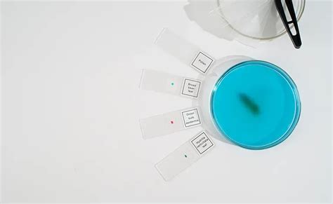 Spermiogram Test Sperm Test How Is The Spermiogram Test