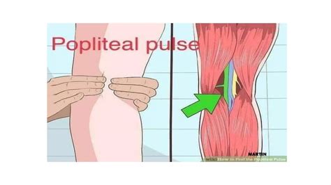 Different Pulse Sites Pulse Introduction And Images Pptx