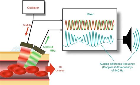 Physical And Technical Principles Of Doppler Sonography Radiology Key