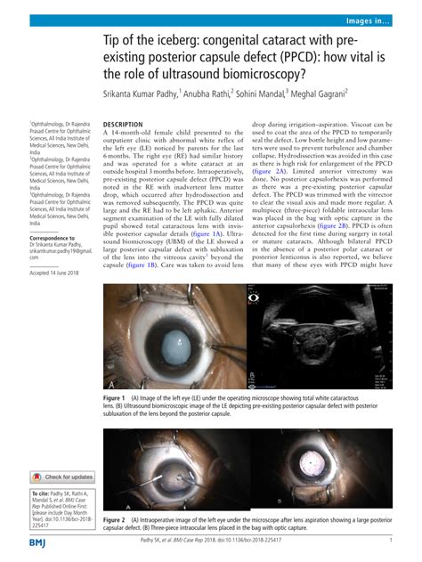 Pdf Tip Of The Iceberg Congenital Cataract With Pre Existing Posterior Capsule Defect Ppcd