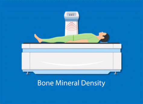 Bone Health After 40 Bone Density Test Bmd Cant Be Ignored