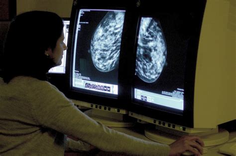 Ai Tool Could Predict Heart Disease Risk In Women Only From Mammogram Age Researchers Daily