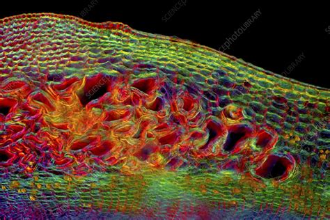 Nettle Stalk Light Micrograph Stock Image C057 8072 Science Photo Library