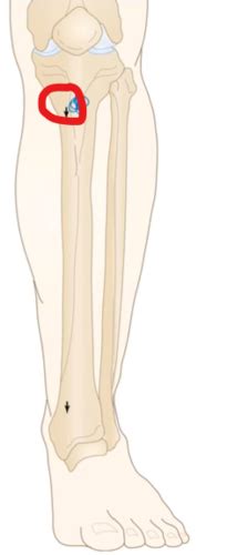 Intraosseous Access Flashcards Quizlet