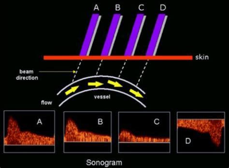 Introduction To Echocardiography IAME