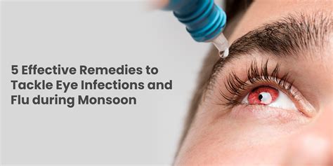 5 Effective Remedies To Tackle Eye Infections And Flu During Monsoon