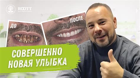 Отзывы пациентов клиники — ROOTT