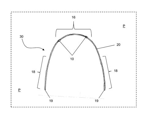 Archwire Assembly With Non Linear Crimpable Orthodontic Stop And Method