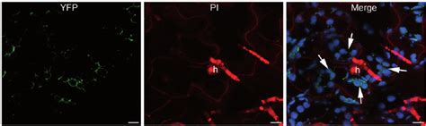 Subcellular Localization Of Rpw81yfp Upon Powdery Mildew Infection A Download Scientific