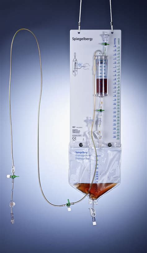 Kit De Drenaje Ventricular Evd3000401 Spiegelberg Graduada