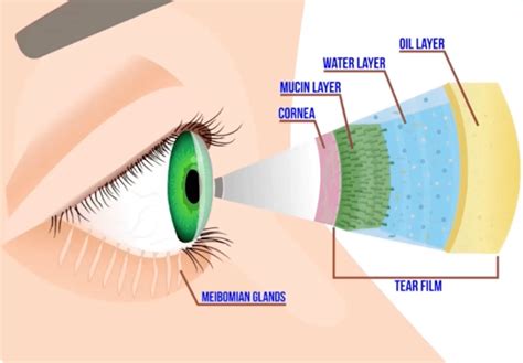 Best Of Both Worlds Optimizing The Ocular Surface And Eyelid Health Management