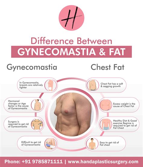 Gynecomastia Vs Chest Fat What Is The Difference