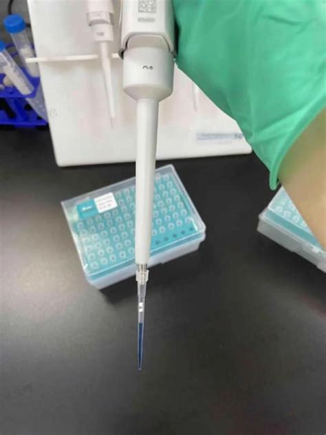 How Do You Measure Bacteria Methods And Techniques Ucallmlabs