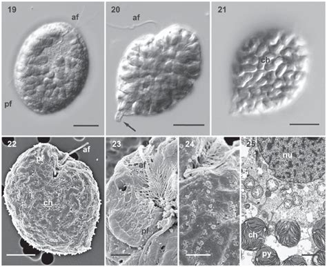 Micrographs Of Chattonella Subsalsa From The Gulf Of Mexico Strain Download Scientific Diagram