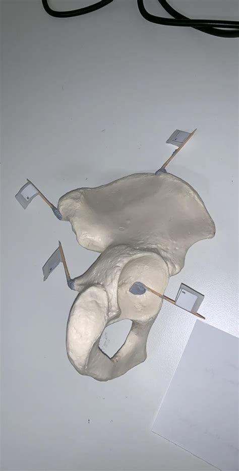Hip Model 1 Diagram Quizlet