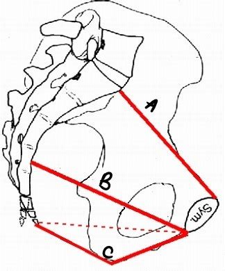 Visual Lab Outline 16 Relations Of Pelvic Visceraandperitoneum