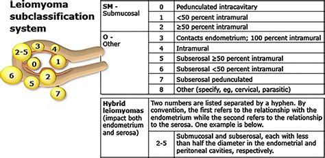 Update On Medical Treatment Of Uterine Fibroids European Journal Of