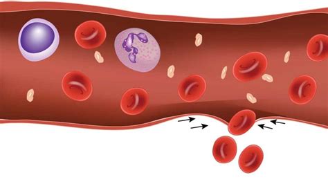 Primary Hemostasis Platelet Plug Formation Steps And Key Players